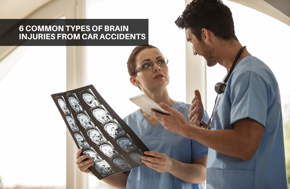 6 Common Types of Brain Injuries From Car Accidents